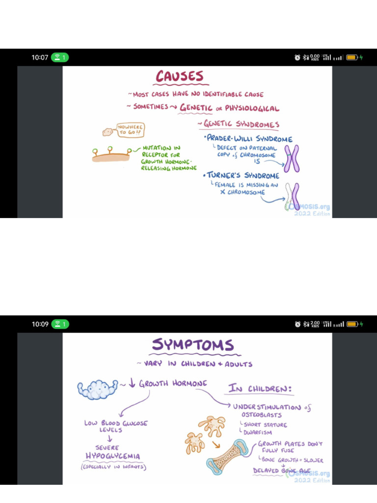 Growth& Hyperthyroidism | PDF