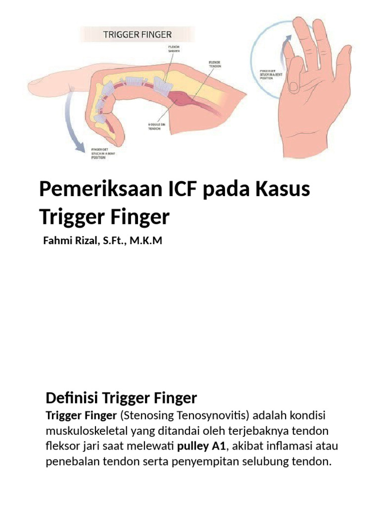 Pemeriksaan ICF - Trigger Finger | PDF