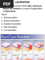 Understanding Stab Wounds: Types & Characteristics | PDF | Knife | Wound