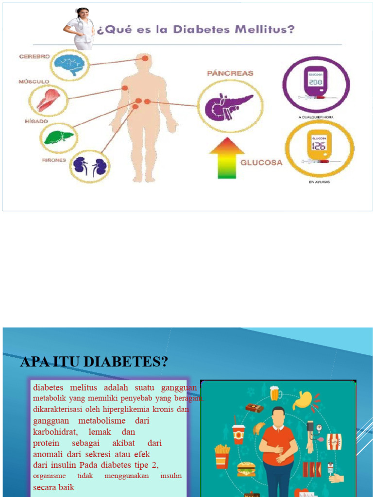 Papan Flip Diabetes Mellitus | PDF