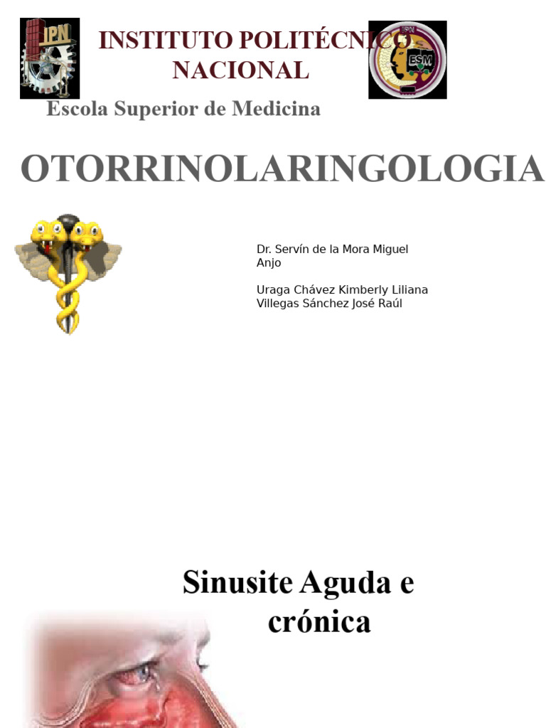 Sinusite Aguda e Crônica | PDF | Doenças e distúrbios | Especialidades ...