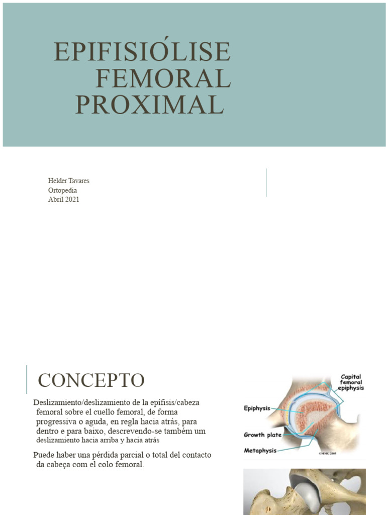 Epifisiólisis Femoral Proximal | PDF | Especialidades Medicas | Sistema ...