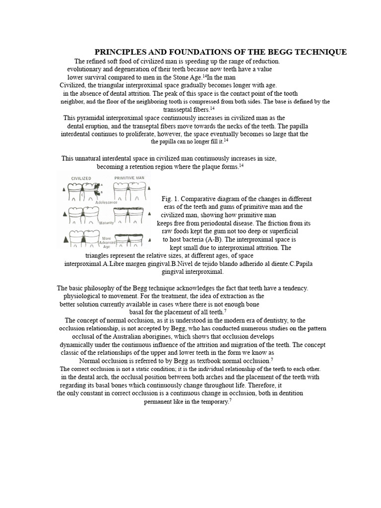 Begg Technique: Dental Movement Principles | PDF | Dental Anatomy ...