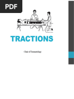 Buck's Extension Traction Overview | PDF