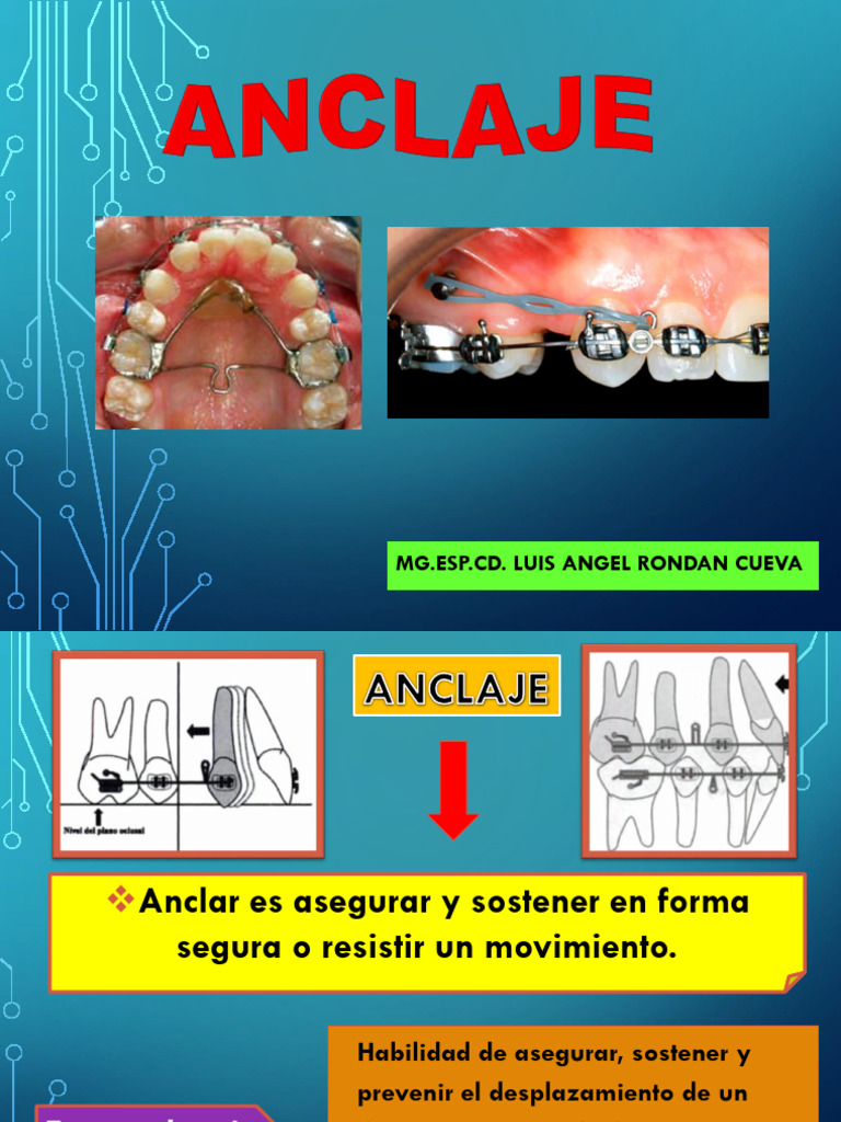 Clase 5 Anclaje Conceptos - Anclaje Minimo - Moderado | PDF ...