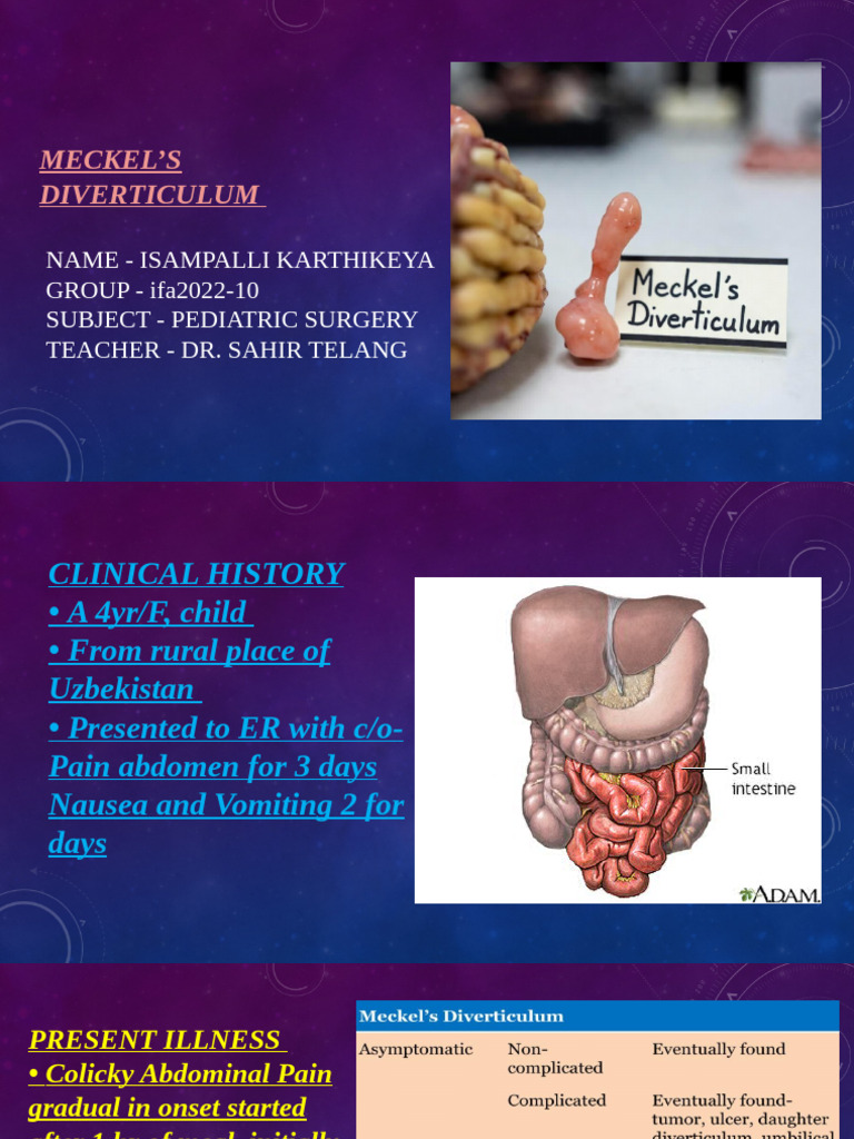 Meckels Diverticulum | PDF | Nausea | Medicine