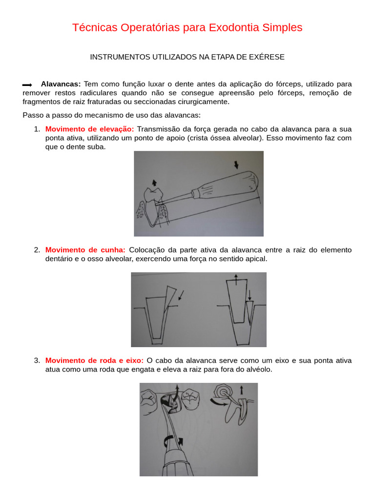 Técnicas e Instrumentos para Exodontia | PDF | Dente humano