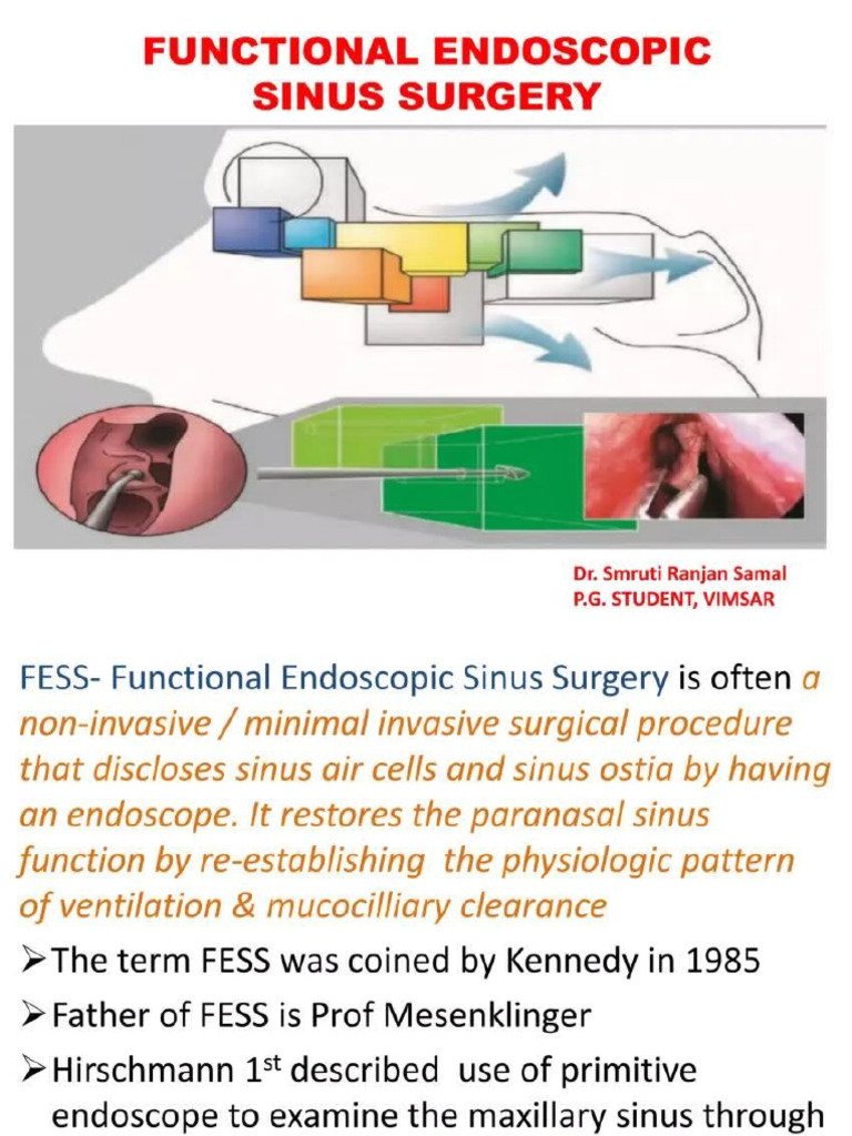 Functional Endoscopic Sinus Surgery - 20251105 - 205921 | PDF