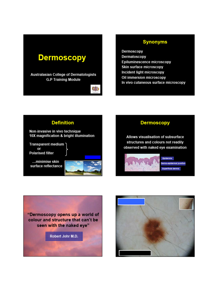 Dermoscopy Presentation | PDF | Integumentary System | Cutaneous Conditions