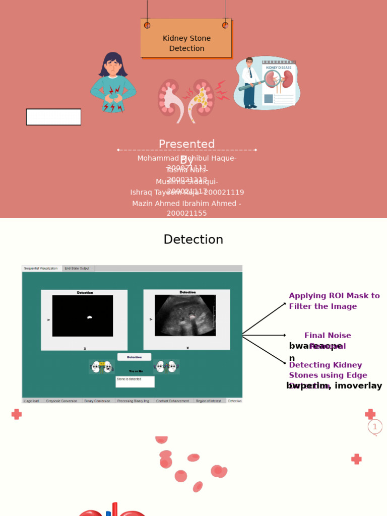 Kidney Stone Detection - EEE 4702 - A1 | PDF