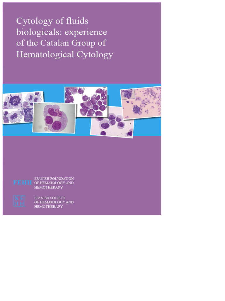 Cytology of Biological Fluids | PDF | Lymphoma | White Blood Cell