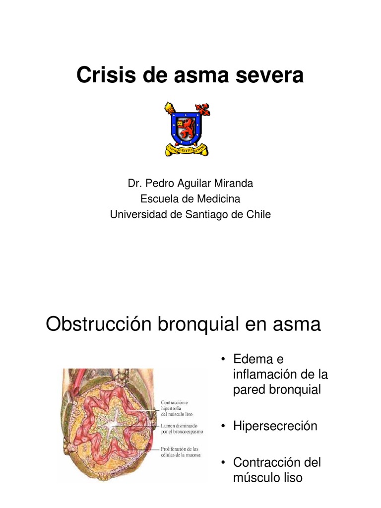 Asma Aguda | Descargar gratis PDF | Asma | Neumología
