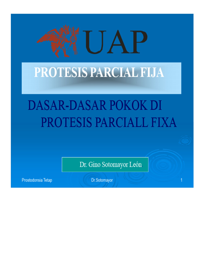 Dasar-Dasar Protesa Partial Fija | PDF