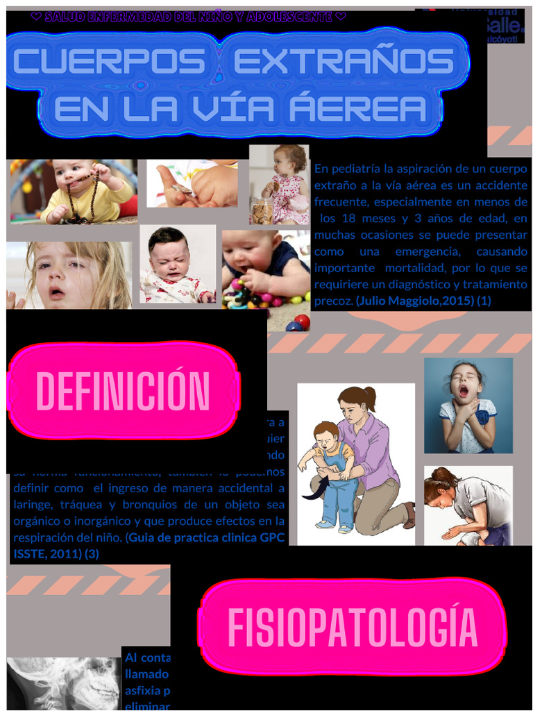 Infographic On Airway Obstruction | PDF