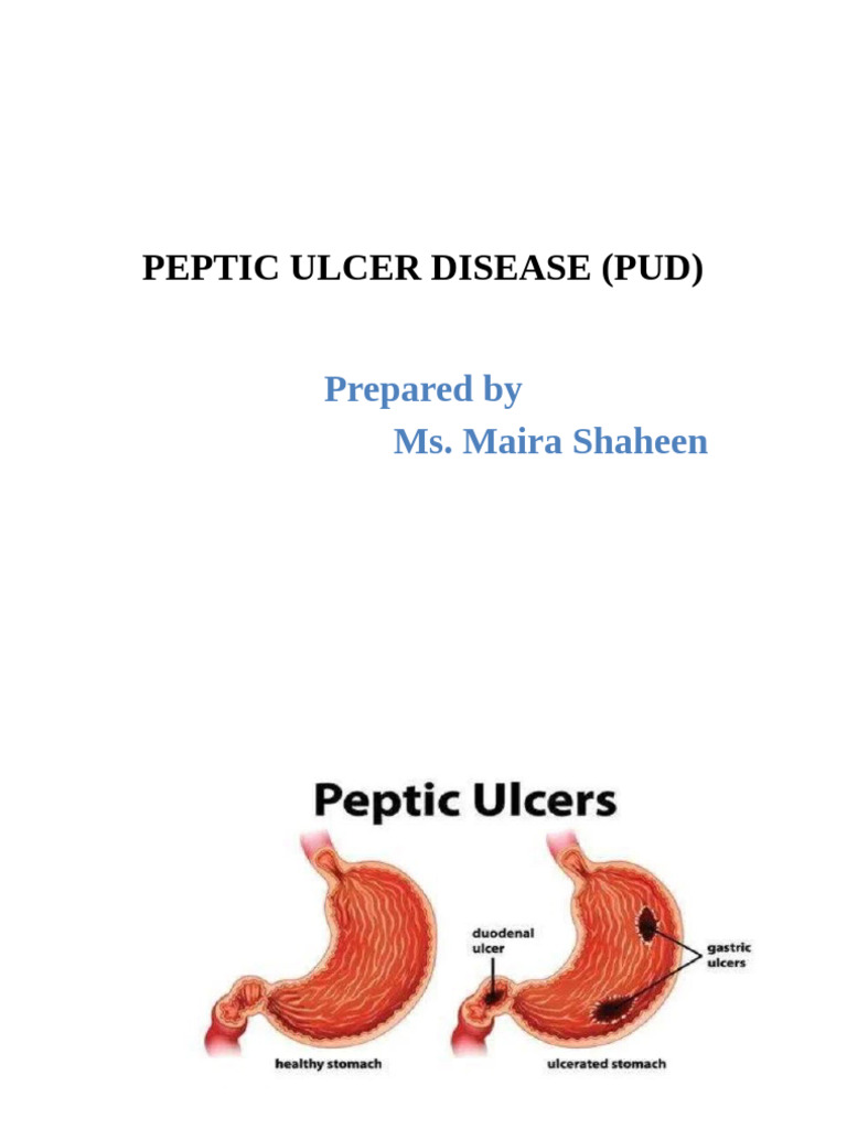 Lect 8. peptic ulcer | PDF | Stomach | Indigestion