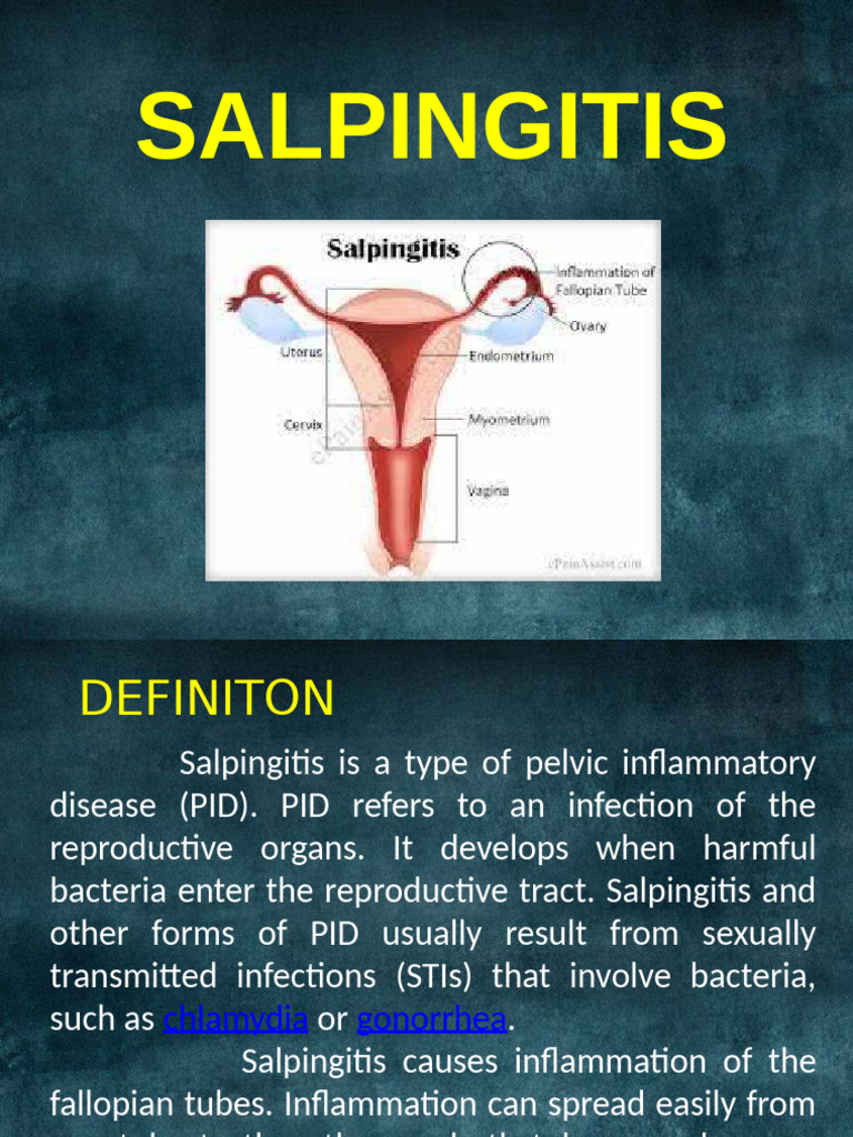 Understanding Salpingitis Symptoms & Causes | PDF