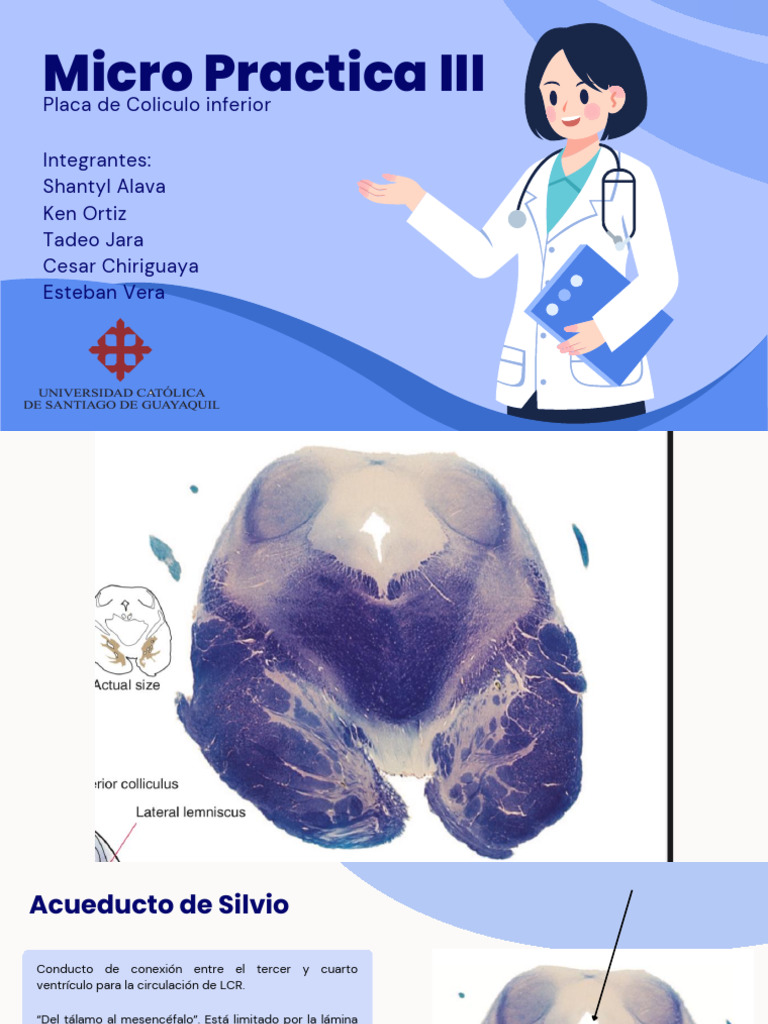 Funciones del Colículo Inferior y Cerebelo | PDF | Cerebelo | Tronco ...