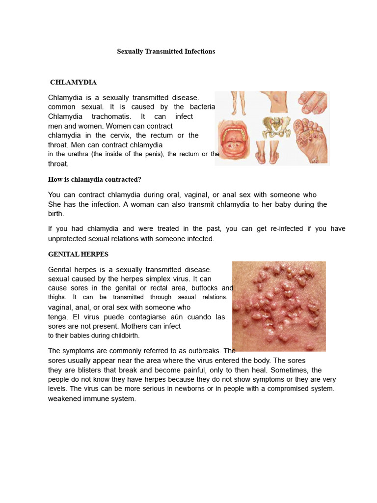 Overview of Common STIs | PDF | Sexually Transmitted Infection | Hiv/Aids