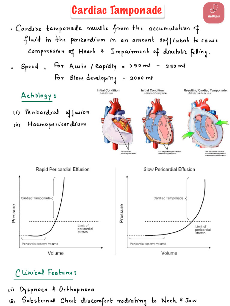 Cardiac Tamponade | PDF | Cardiovascular System | Heart