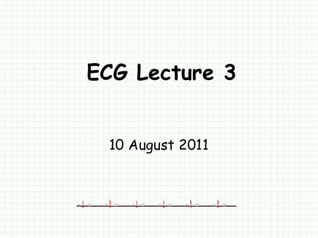 Practice ECGs | PDF