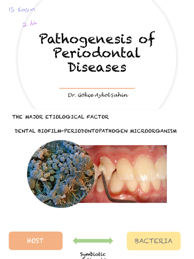 8.2 - Pathogenesis of Periodontal Diseases Part-1 | PDF | Immune System ...