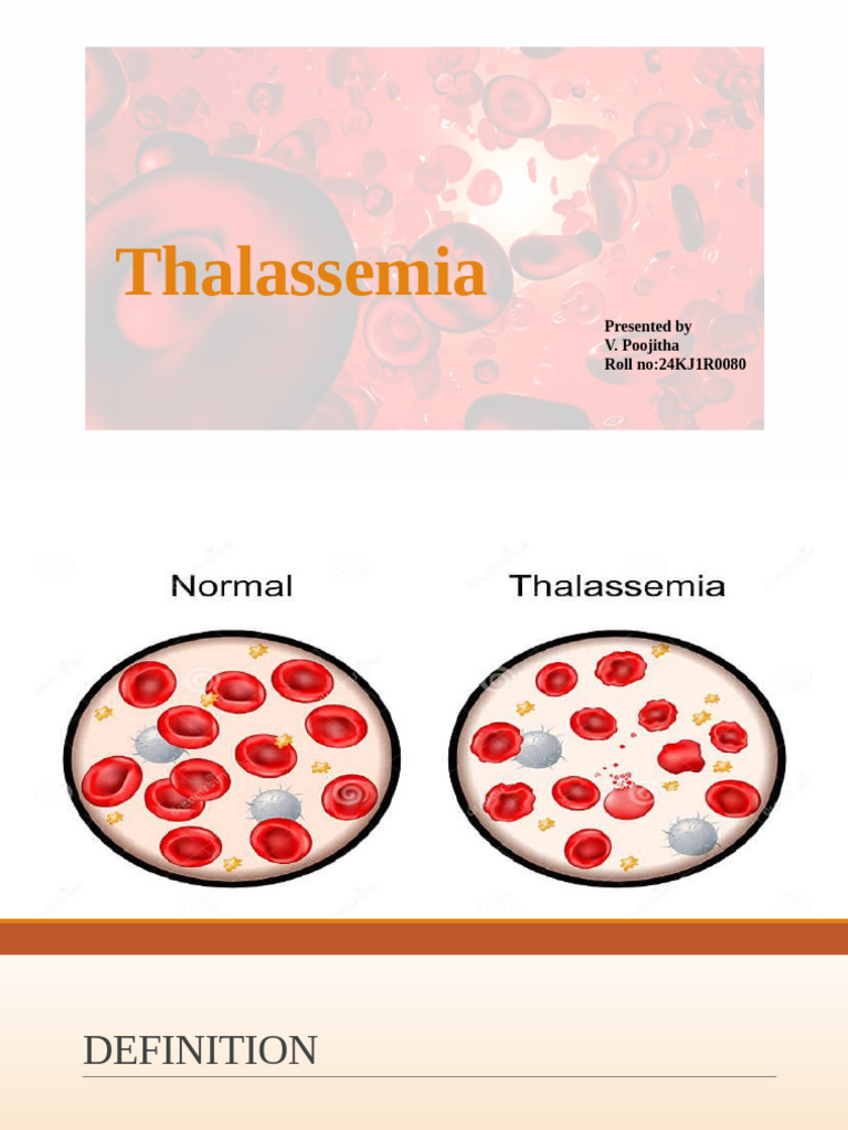 Understanding Thalassemia: Types & Treatment | PDF