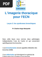 Syndrome bronchique et épaississement pariétal | PDF