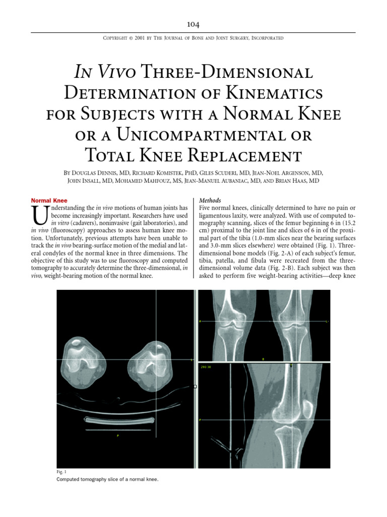 In Vivo Three-Dimensional Determination of Kinematics For Subjects With ...