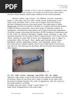 Cadaveric Spasm: Forensic Significance | PDF