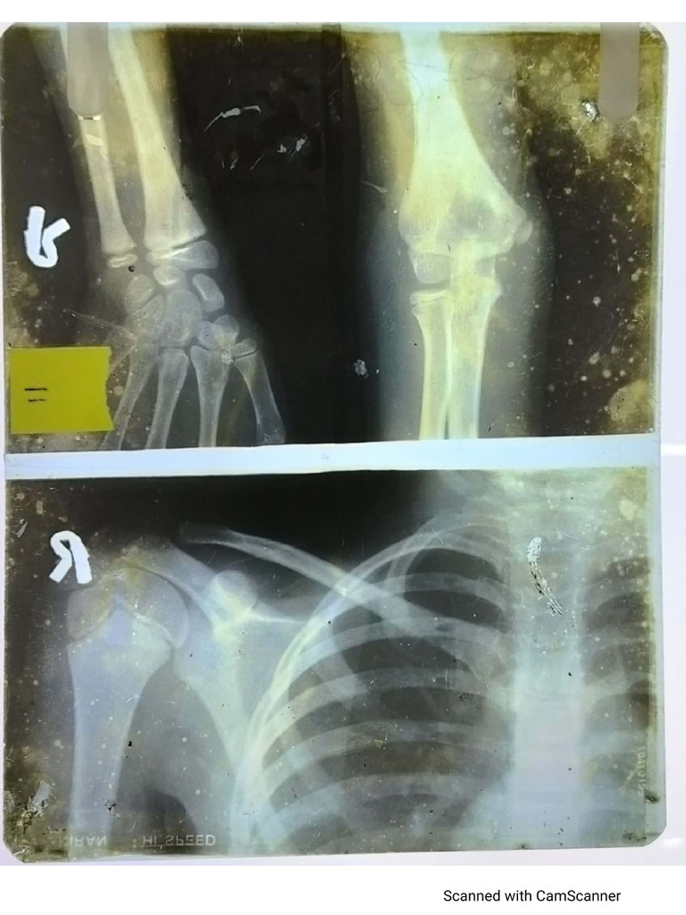 FM X-Rays | PDF