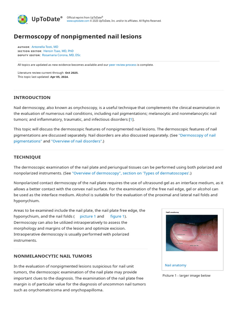 Dermoscopy of Nonpigmented Nail pToDate | PDF | Psoriasis | Nail (Anatomy)