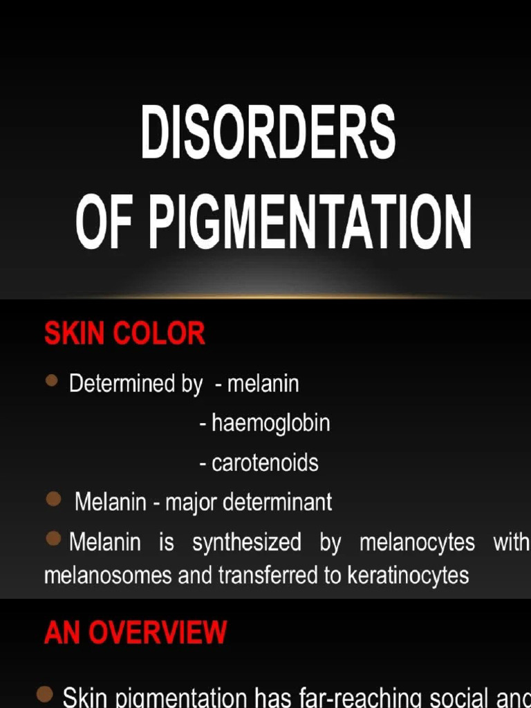 Disorders of Pigmentation-1 | PDF