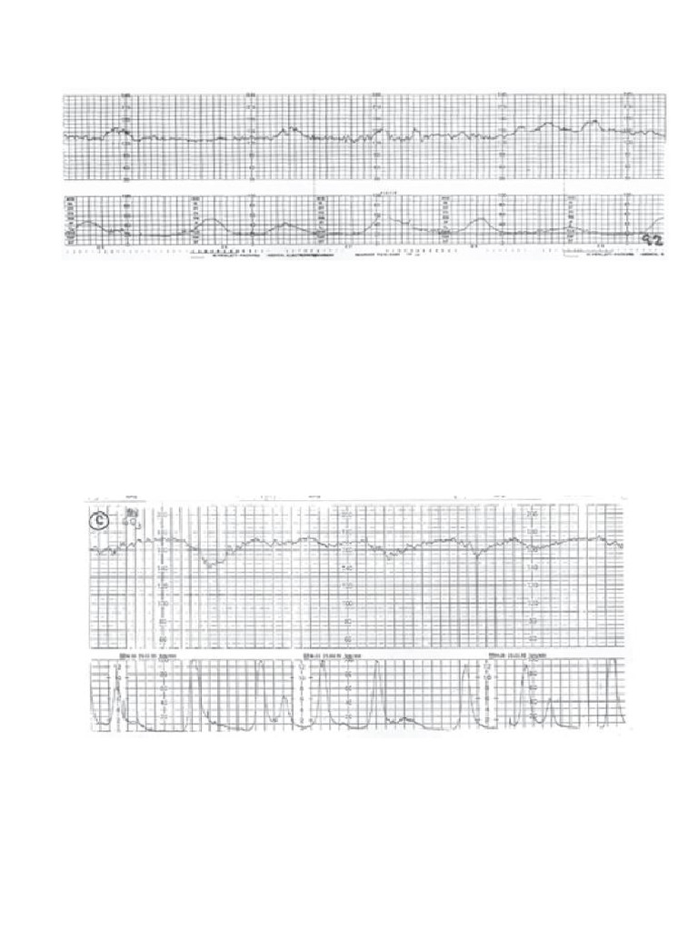 Monitor Eo | PDF