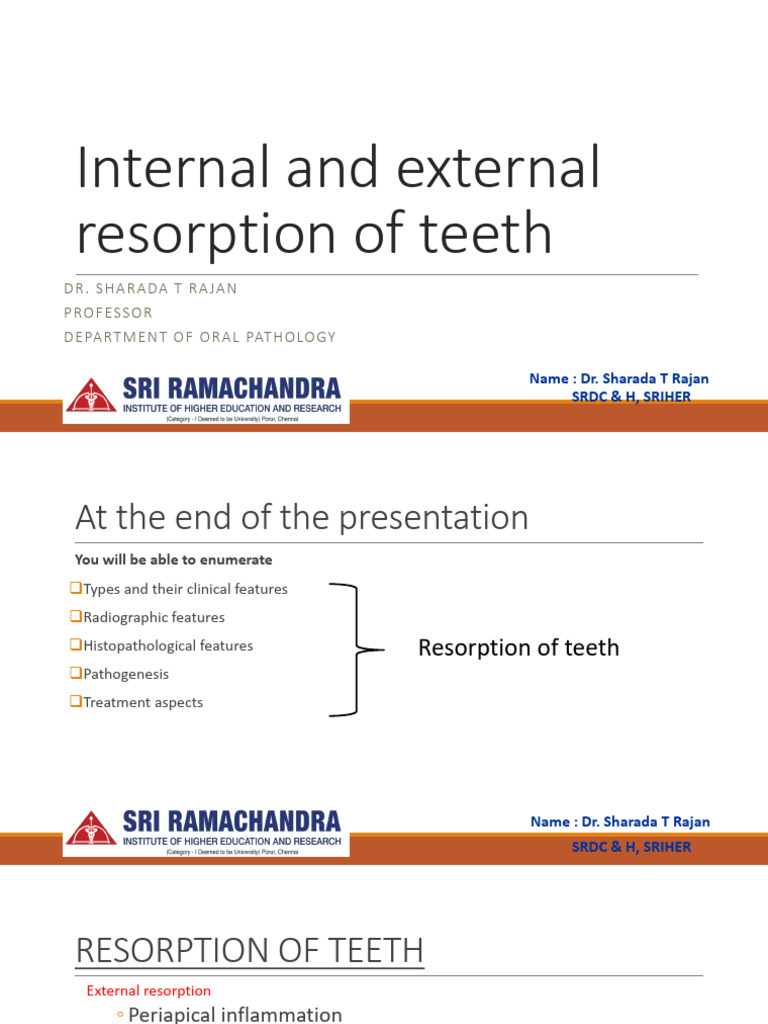 Internal and External Resorption of Teeth | PDF | Human Tooth | Tooth
