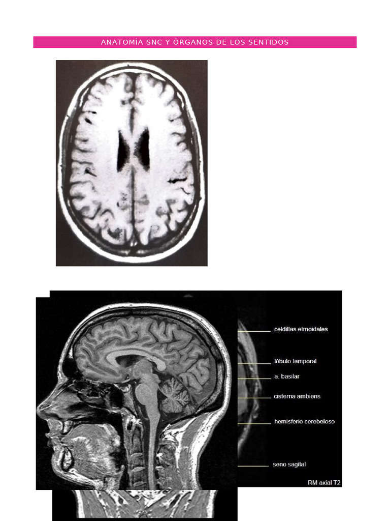 Anatomía SNC y Órganos de Los Sentidos | PDF