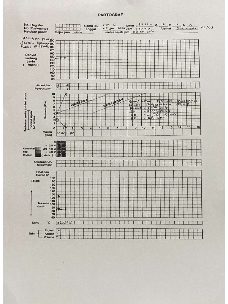 Partograf 7 NY. G | PDF