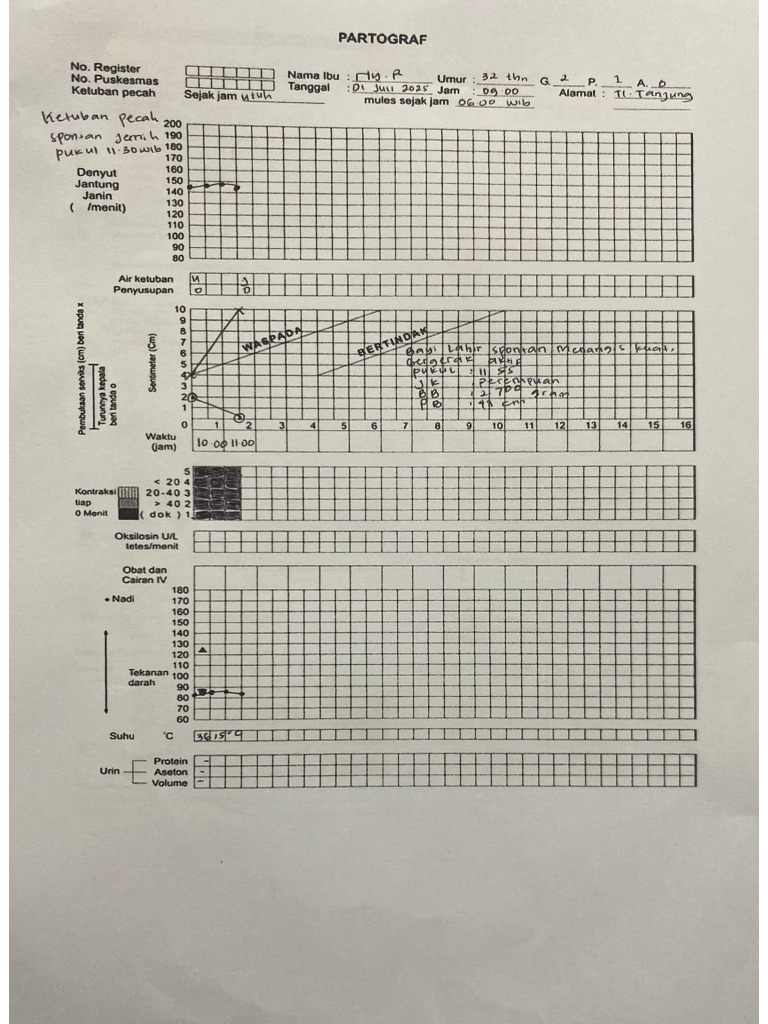 Partograf 4 NY. R | PDF