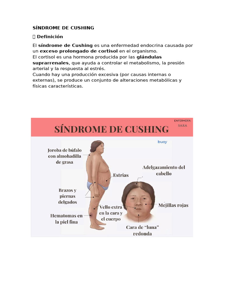 SÍNDROME DE CUSHING | PDF | Cortisol | Hormona adrenocorticotrópica