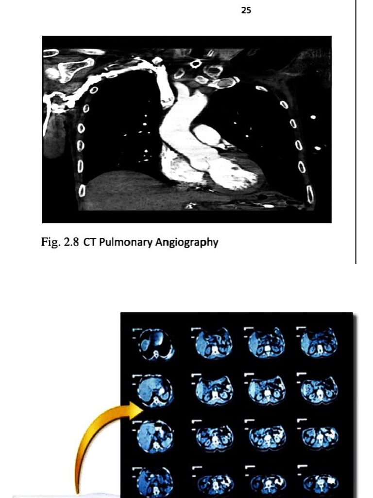 CT Scan Diagrams | PDF