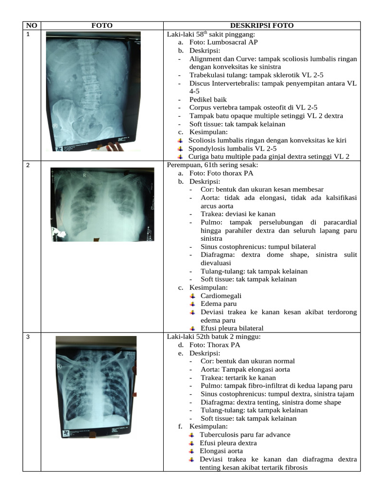 Diagnosa Radiologi Penyakit Paru dan Tulang | PDF