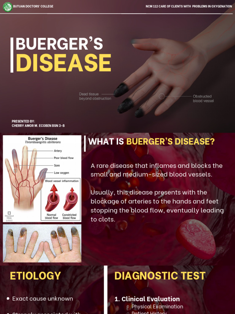 Buerger's Disease | PDF | Angiology | Cardiovascular System