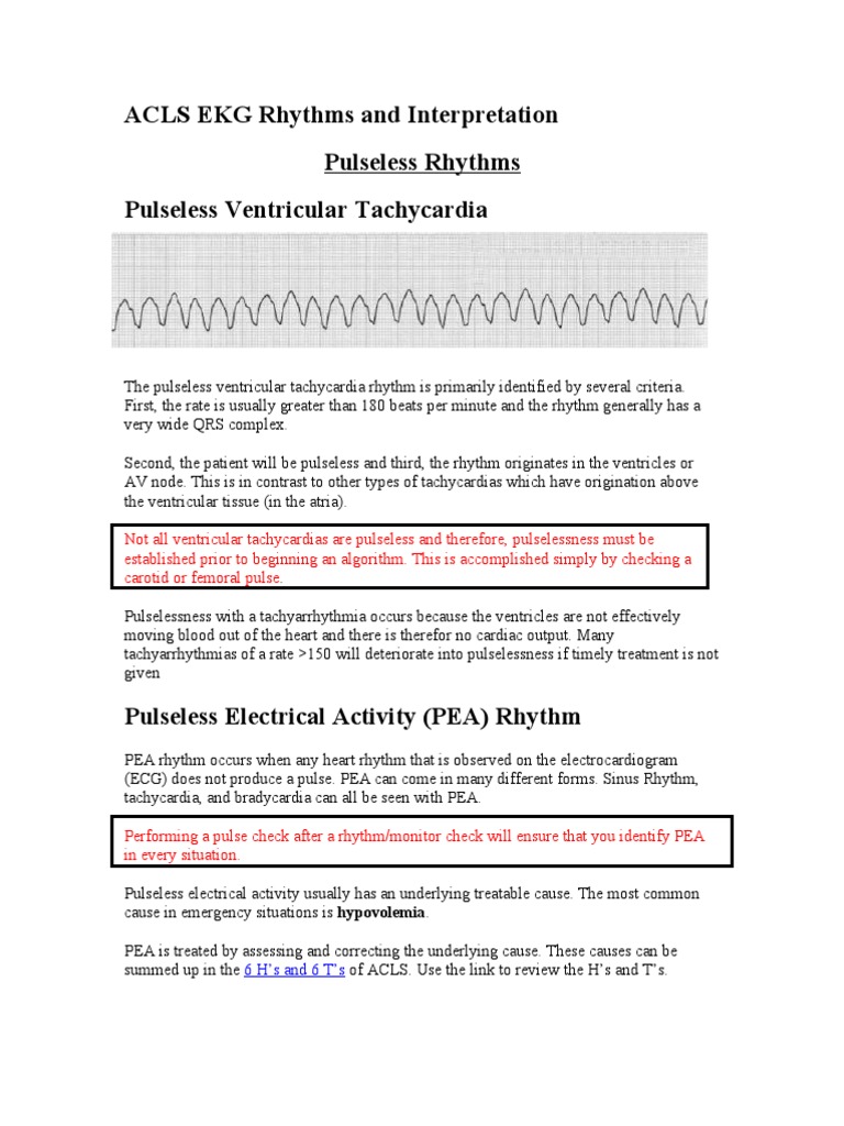 ACLS EKG Rhythms and Interpretation | Heart | Electrocardiography