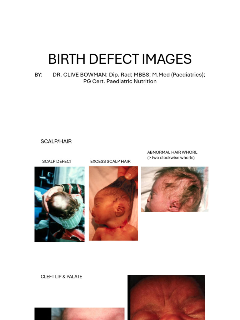 Comprehensive Guide to Birth Defects | PDF | Congenital Disorder