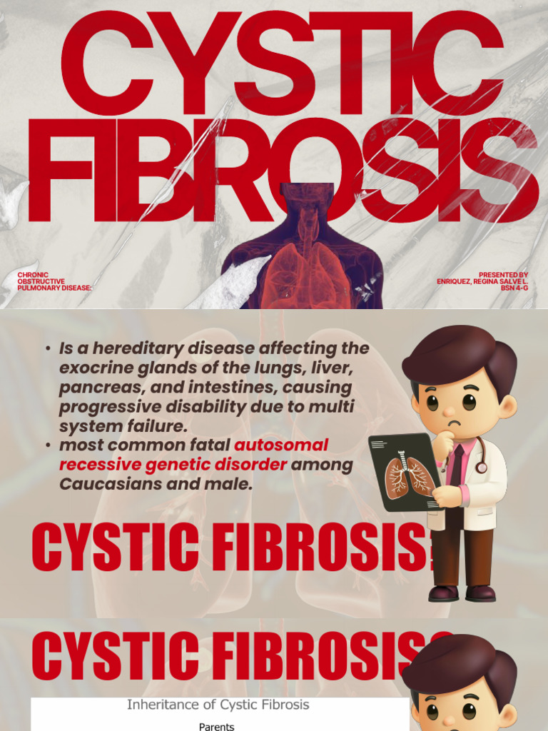 Understanding Cystic Fibrosis and Management | PDF