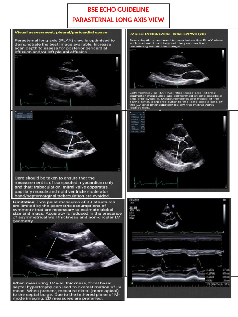 BSE Echo Guidelines for Cardiac Views | PDF
