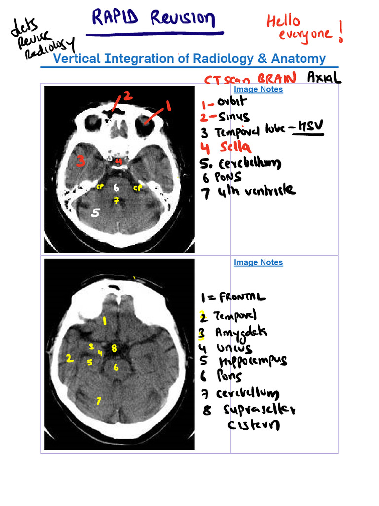 Radiology and Anatomy Integration Guide | PDF | Radiology | Medical ...