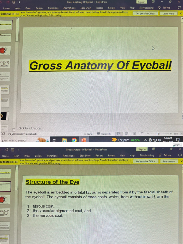 Gross Anatomy of Eyeball | PDF
