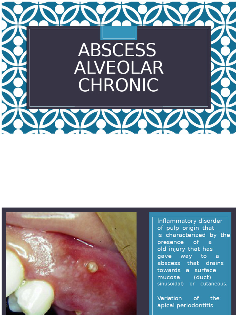 Chronic alveolar abscess | PDF