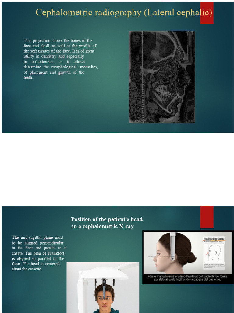 cephalometric radiography | PDF | Skull