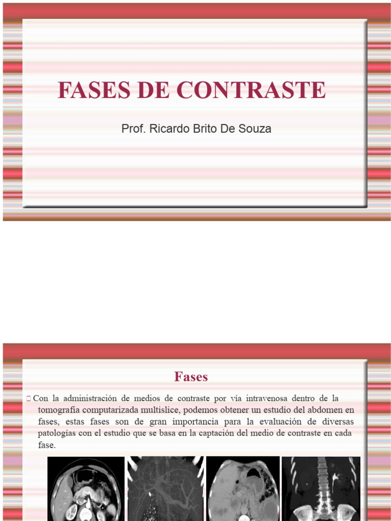 Fases de Contraste 1-1 | PDF | Artería | Sistema circulatorio
